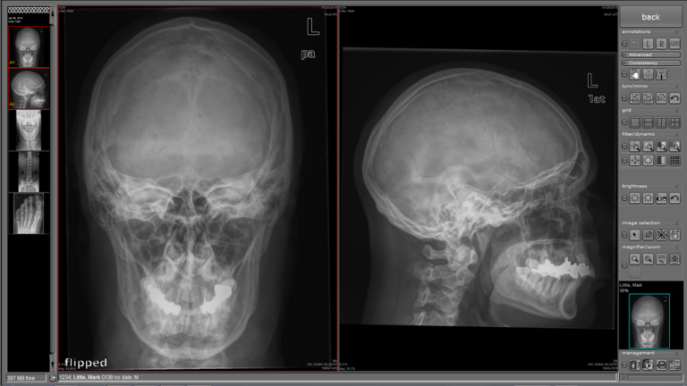DX-R X-Ray Acquisition Software | Calico Medical Incorporated